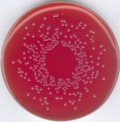 BPLS-Agar modifiziert Brillantgrün-Phenolrot-Lactose-Saccharose-Agar ...